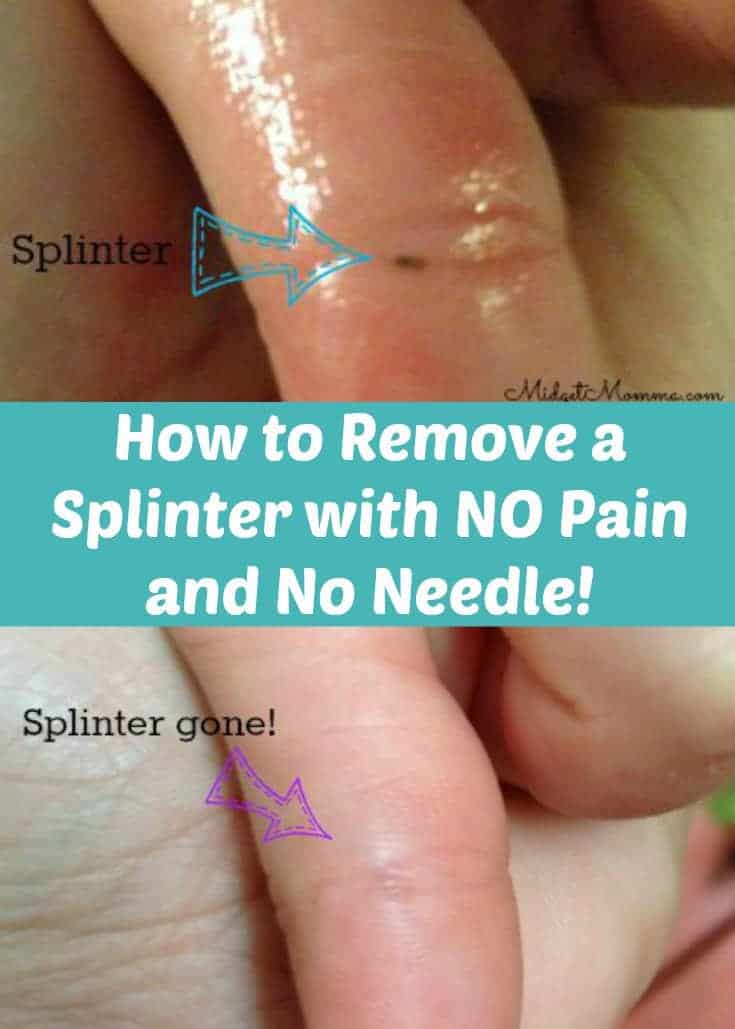 How To Remove Splinters Using Thieves Oil Essential Oils